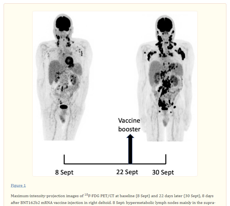 Turbo Cancer Post mRNA Shot Effects? California Photographer Mike Lim ...