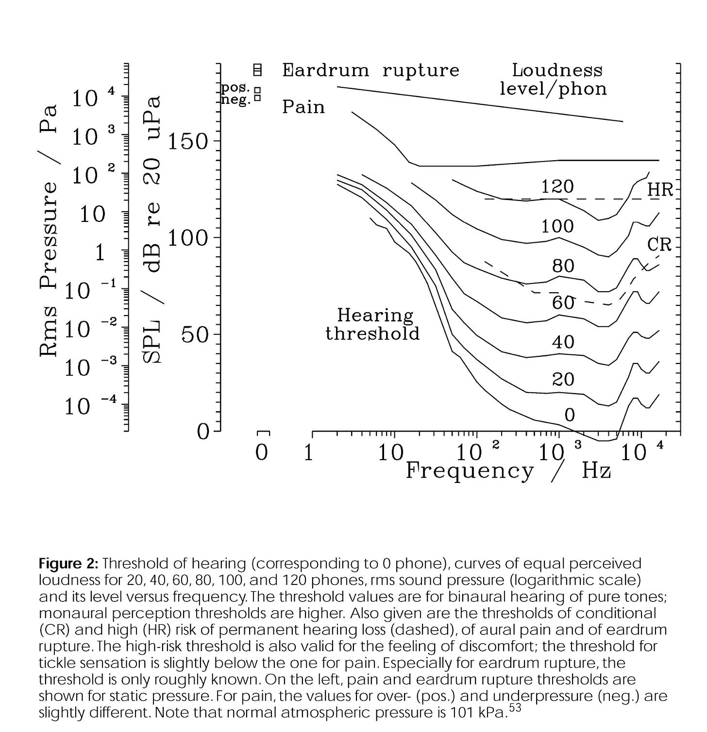 Long Range Acoustic Device (LRDA) [i] - by Mike Mihajlovic