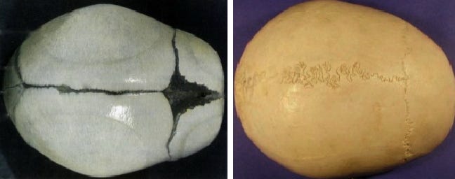 5.4 MARPE Surgical Assists - From Least to Most Invasive