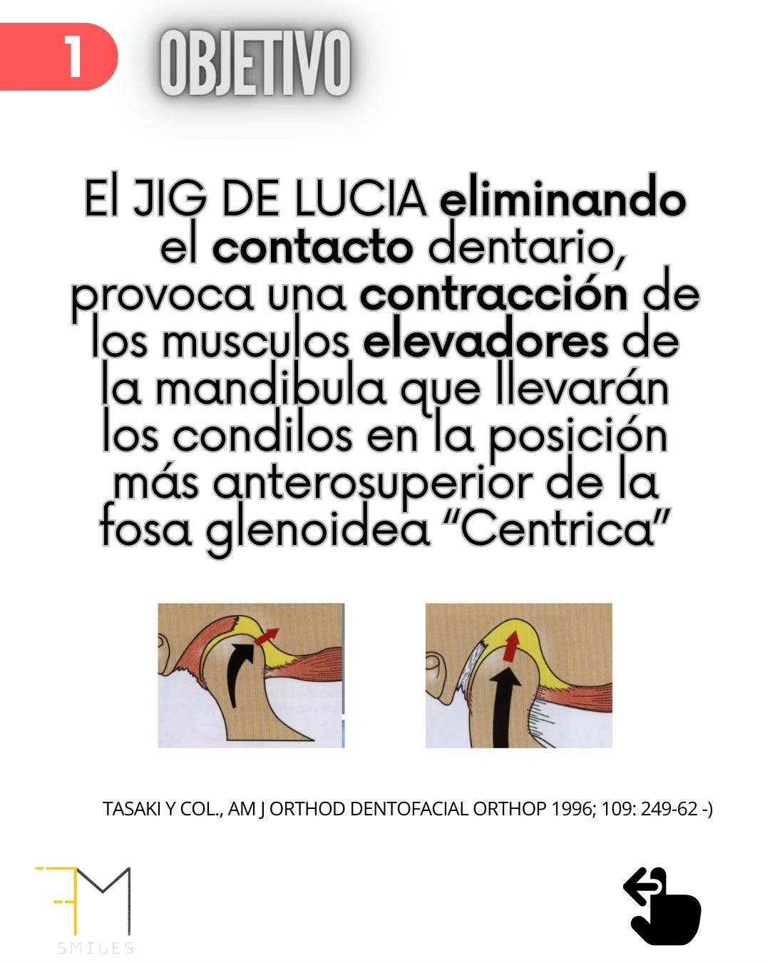 Aumento de la dimensión vertical Cap.1: El Jig de Lucia