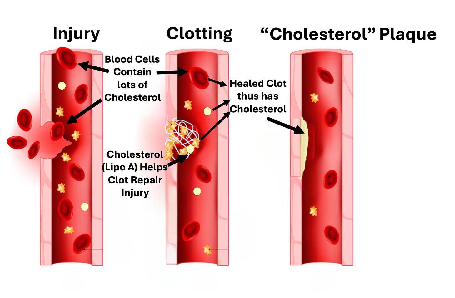 The Great Cholesterol Scam and The Dangers of Statins