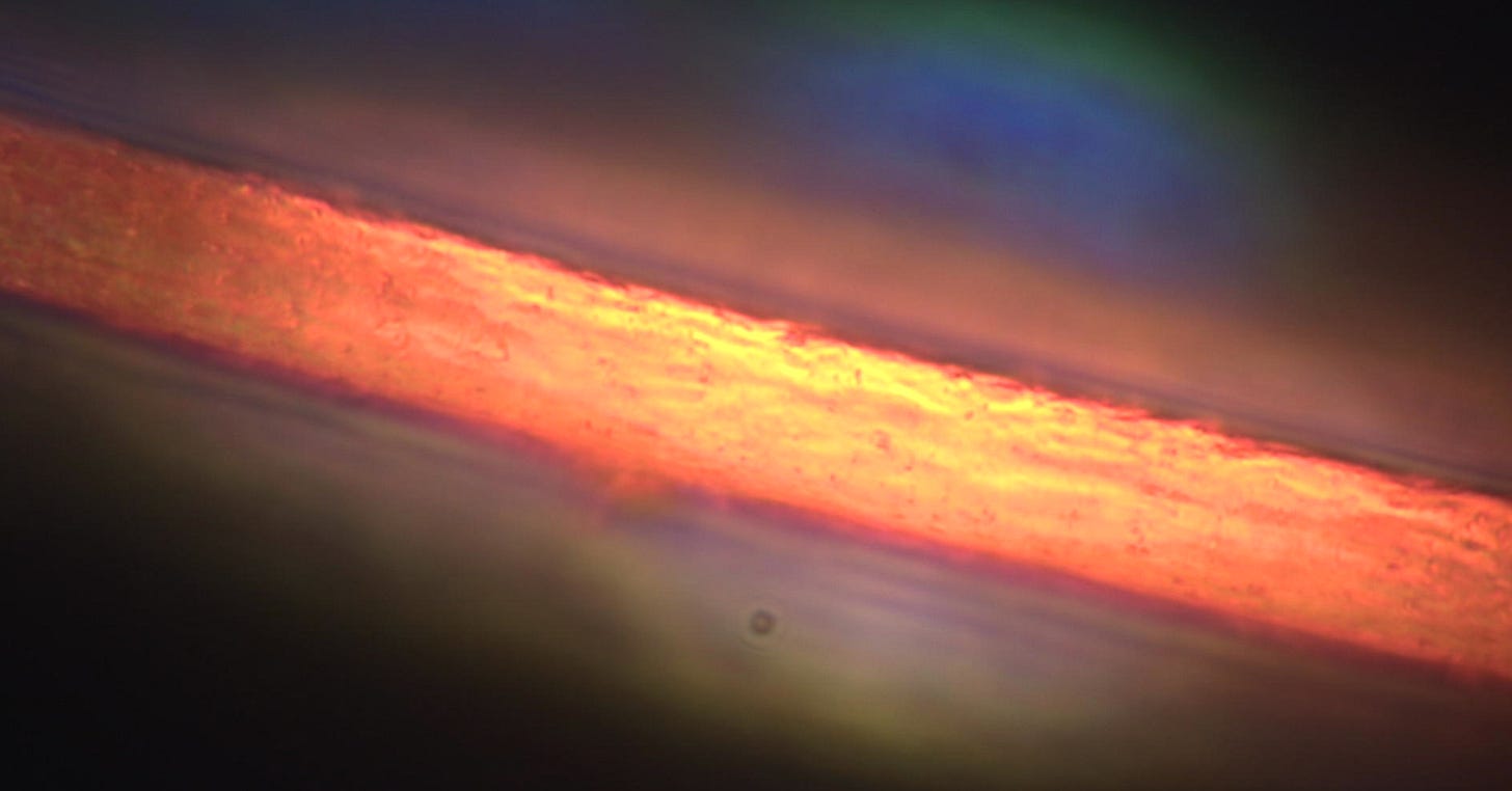 Fluorescent Filaments Coming Out Of C19 Vaccinated Individuals Skin ...