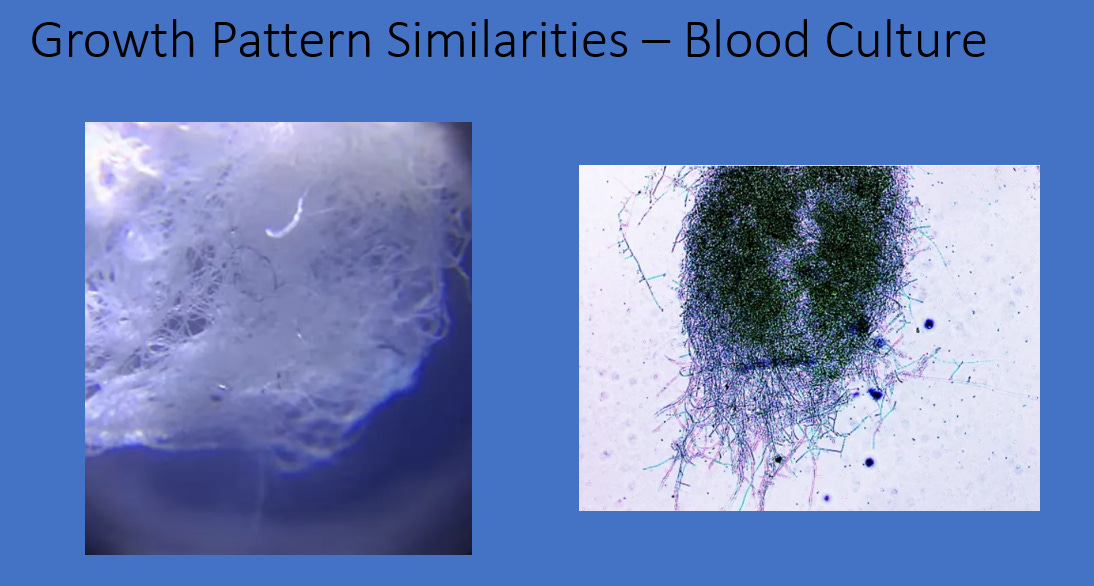 Comparison Images of Live Blood Analysis and Nanotechnology Coming Out ...