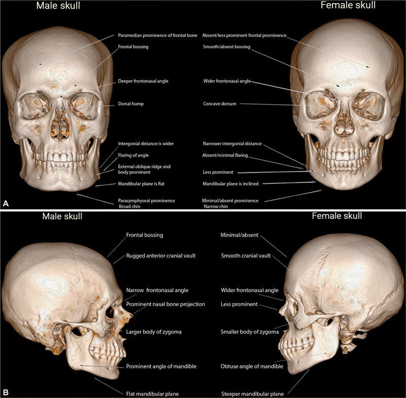What Makes Men and Women Different? - by Tomas Pueyo