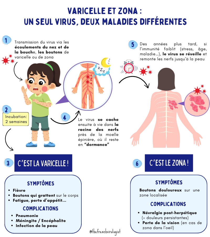 🦠 Varicelle, Zona et Vaccins : Ce Qu’on Ne Vous Dit Pas🤒