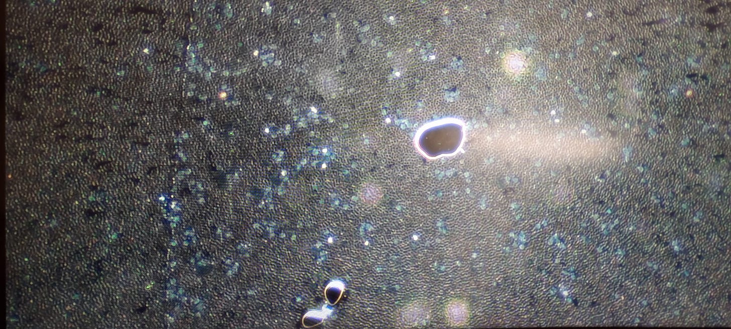 Exploding gel bubbles and WBC's, Glaucoma meds, bot breath and sundry.