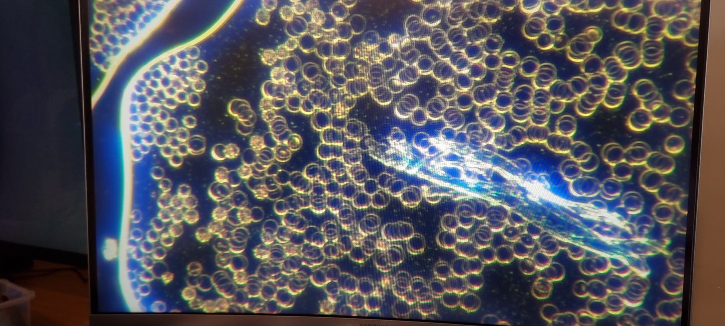 Exploding gel bubbles and WBC's, Glaucoma meds, bot breath and sundry.