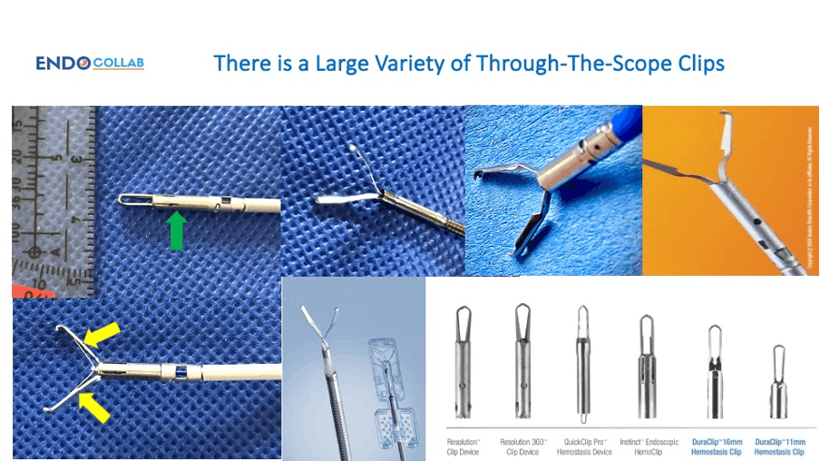 Mastering the Use of Hemoclips (Through-The-Scope-Clips) – EndoCollab