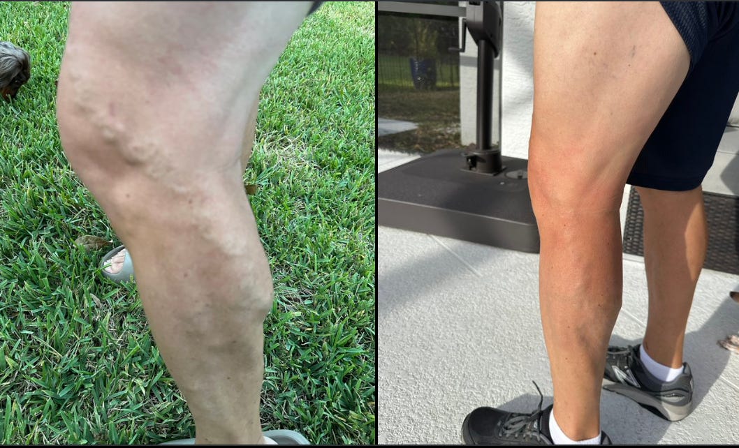 DMSO Revolutionizes Skin Care and Dermatology