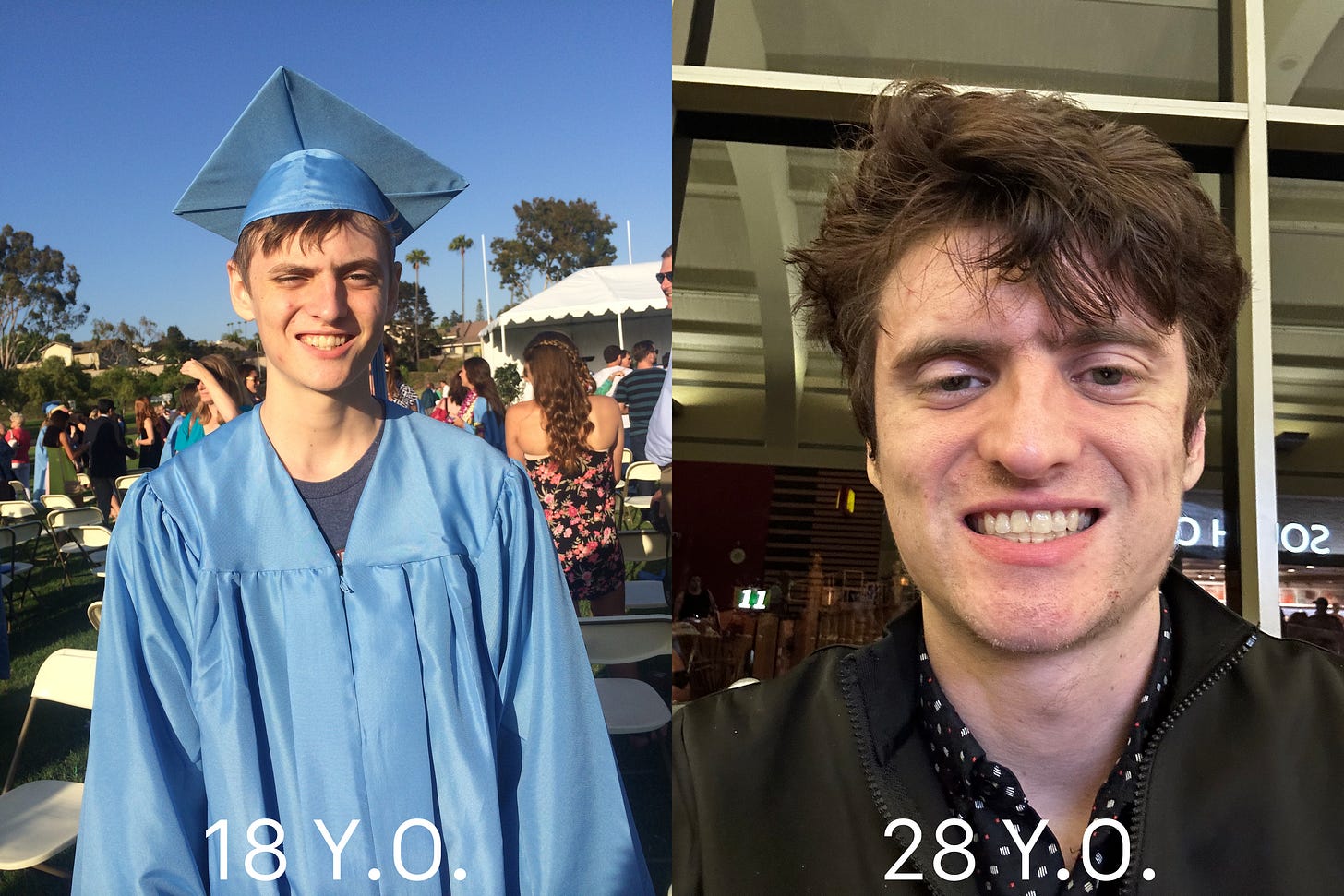 Shrinking the Skull With Cell Therapy - by Robert McDougal