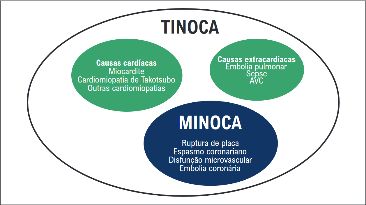 MINOCA, o que fazer?