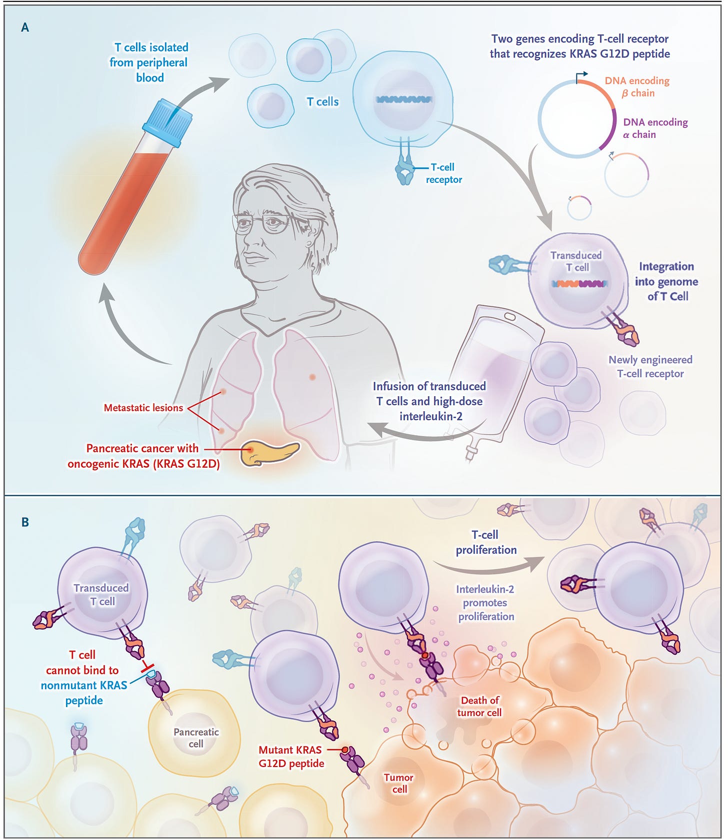 Engineering T cells - by Eric Topol - Ground Truths