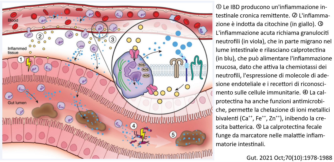🔎 APPROFONDIMENTO: Calprotectina fecale