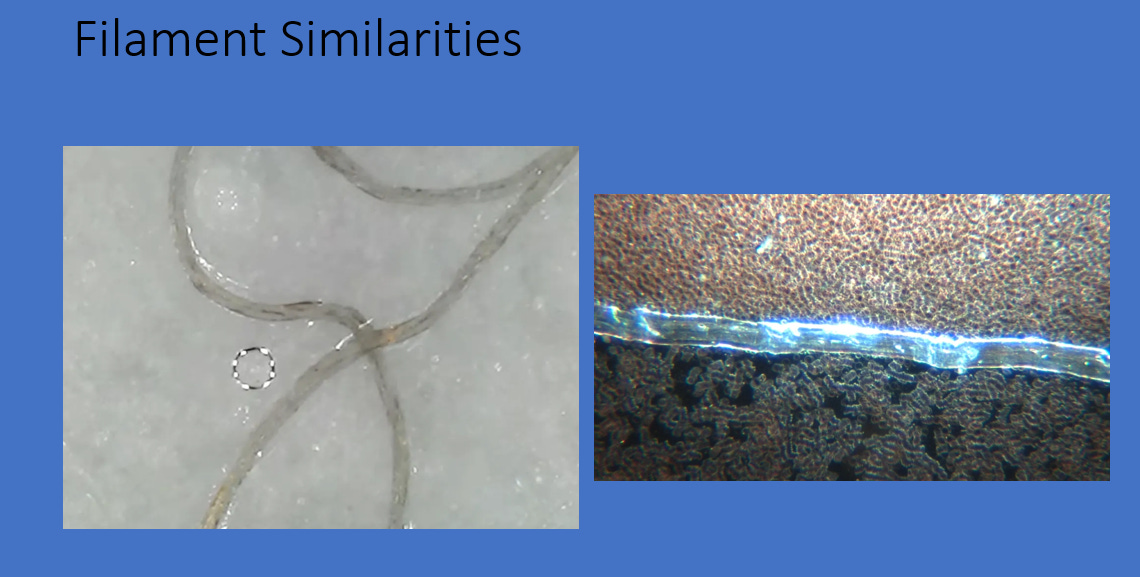 Comparison Images of Live Blood Analysis and Nanotechnology Coming Out ...