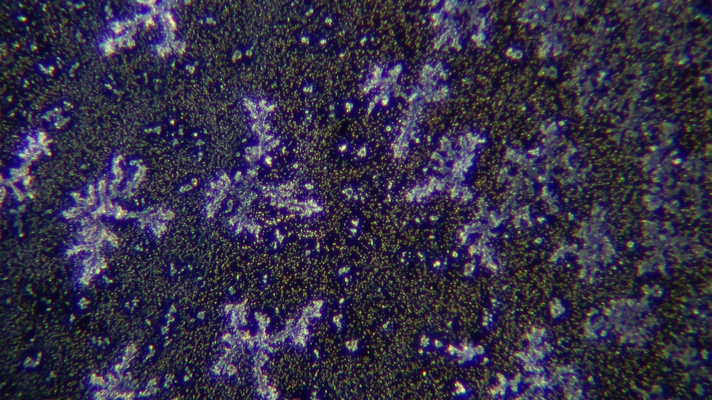 Microscopy of Rain-, Well- & Reverse Osmosis Filtered Tap Water, Boiled ...