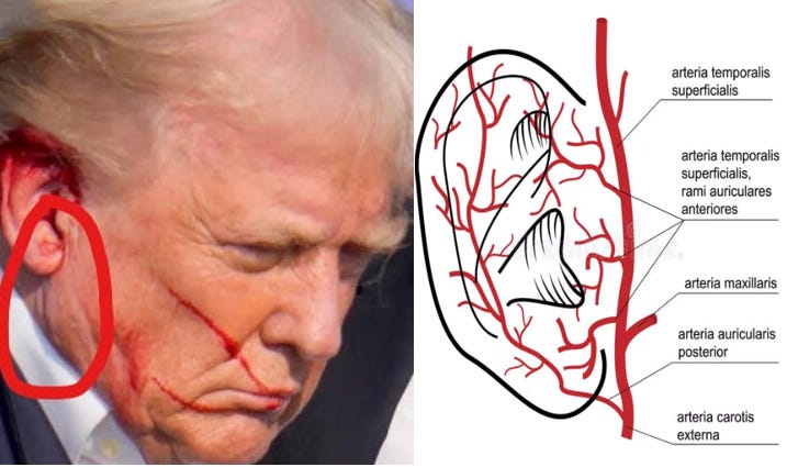 23 Solid Reasons to Suspect Trump’s "Assassination Attempt" was Faked ...