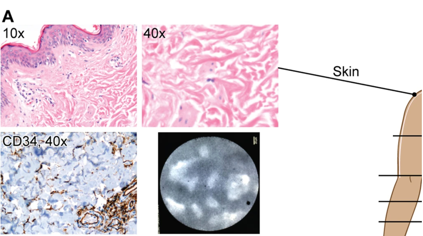 DMSO Revolutionizes Skin Care and Dermatology