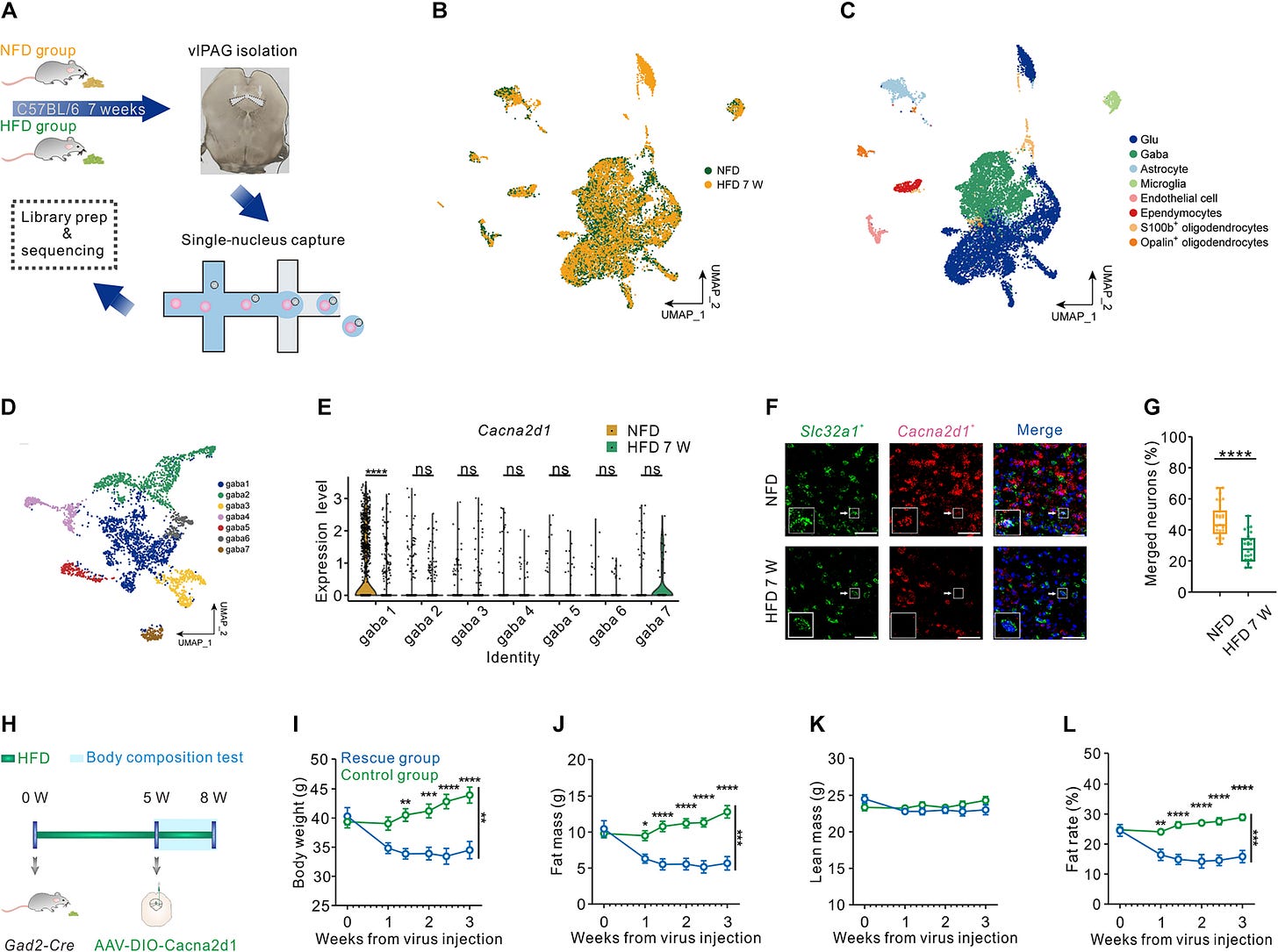 High-calorie Food Causes Changes in the Brain - by Linwen
