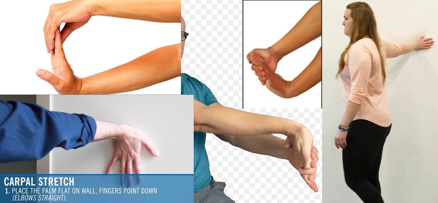 The Forgotten History of Carpal Tunnel Syndrome