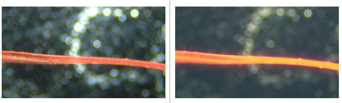 Fluorescent Filaments Coming Out Of C19 Vaccinated Individuals Skin ...