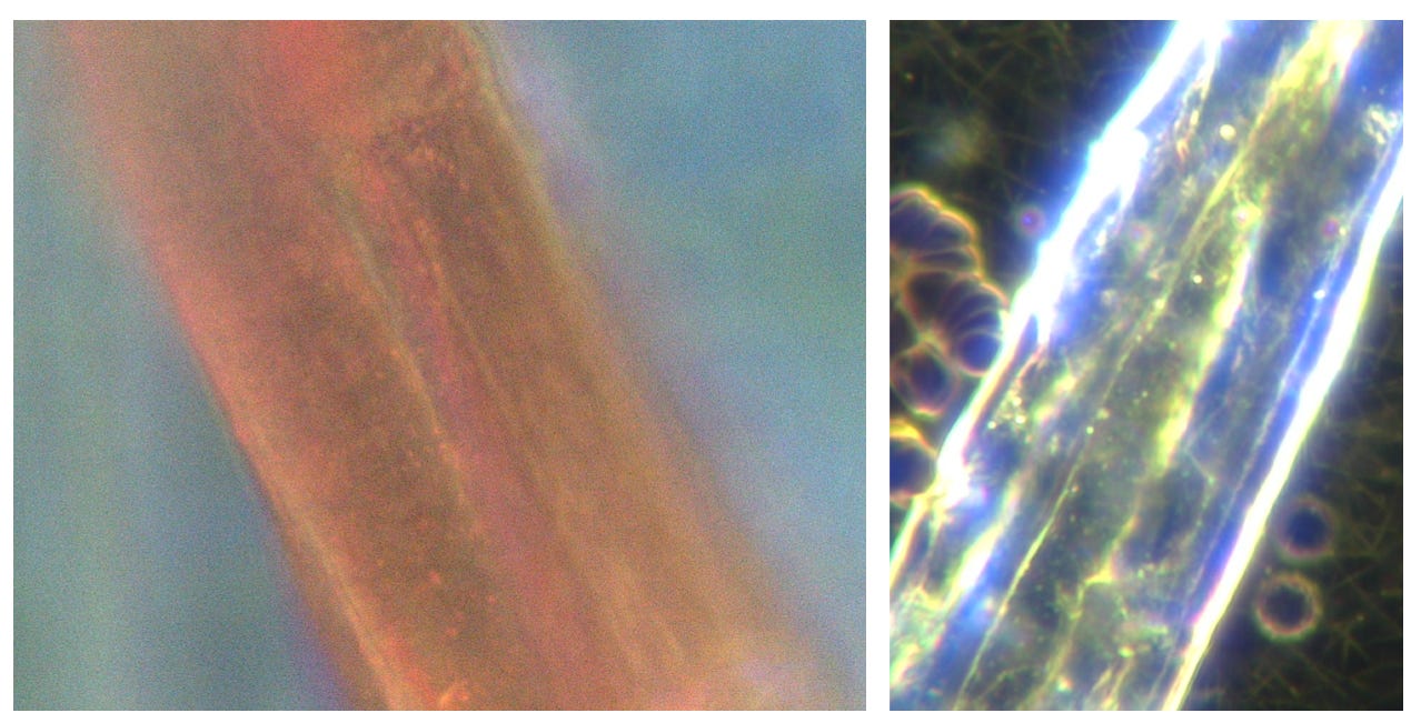 Fluorescent Filaments Coming Out Of C19 Vaccinated Individuals Skin ...