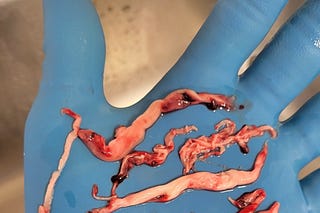 Clotastrophe | Laura Kasner | Substack