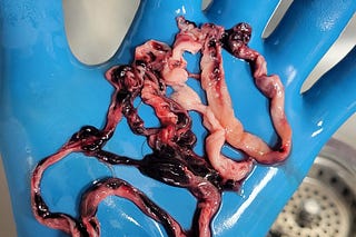 Clotastrophe | Laura Kasner | Substack