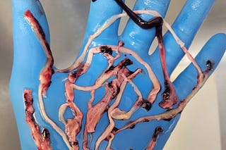 Clotastrophe | Laura Kasner | Substack