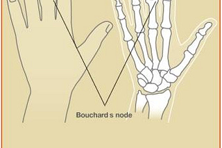 A Spoonful of Sugar | John Rochat - NorCal | Substack