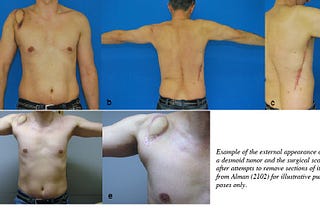 Fenbendazole Can Cure Cancer | Ben Fen | Substack