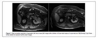 Fenbendazole Can Cure Cancer | Ben Fen | Substack