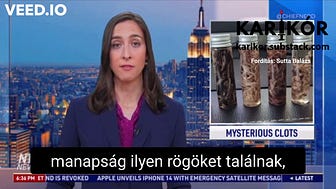 Bell-féle arcidegbénulás (Bell-parézis) - KariKór