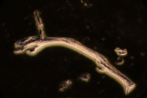 The Usual Suspects: A Field Guide to Common Nanos under the Microscope