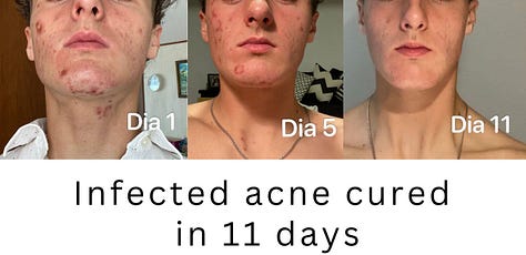 Chlorine Dioxide for Skin Diseases and Skin Conditions