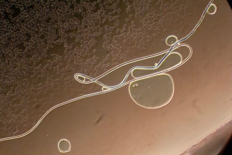 The Usual Suspects: A Field Guide to Common Nanos under the Microscope