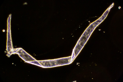 The Usual Suspects: A Field Guide to Common Nanos under the Microscope