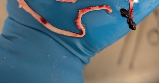 Clotastrophe | Laura Kasner | Substack