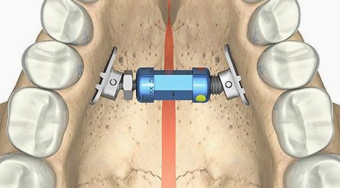 JawHacks | Ronald Ead | Substack