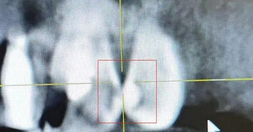 硅魚 silicon.salmon | Substack