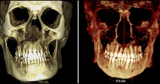 JawHacks | Ronald Ead | Substack