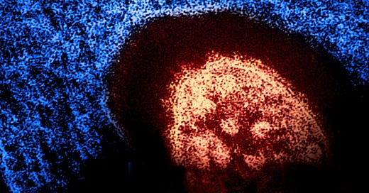 Outbreak News Today | Robert Herriman | Substack