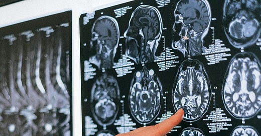 Jeffrey Dahmer’s Brain: Inside the Mind of a Serial Killer