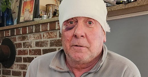 The Bollard | Chris Busby | Substack