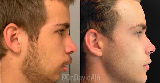 JawHacks | Ronald Ead | Substack