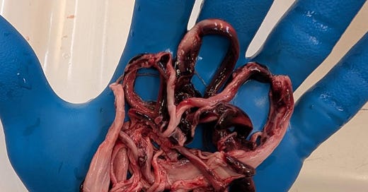 Clotastrophe | Laura Kasner | Substack