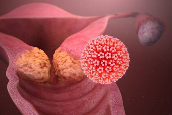 ImmunoLogic | Dr. Andrea Love | Substack