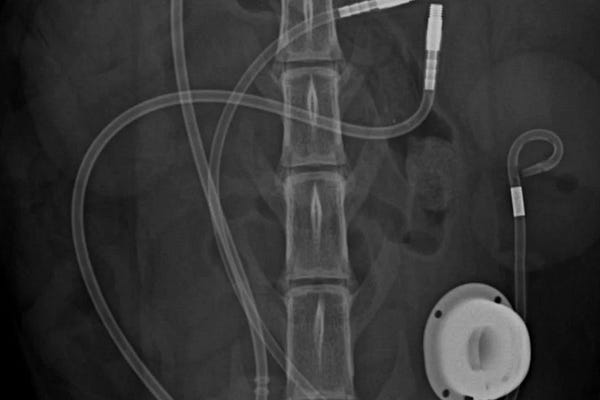 VETPIL | Carlos Martínez Gil | Substack