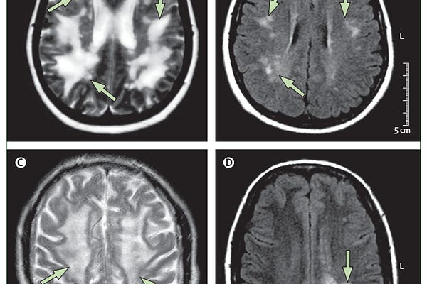 Mac Gayver Castro | Substack