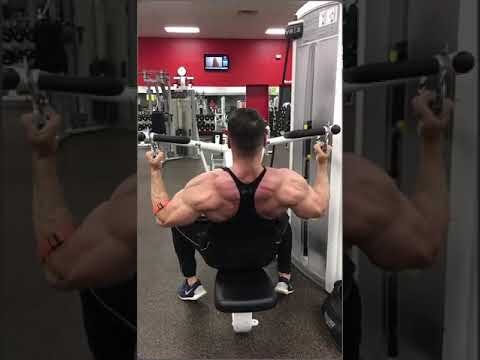 Video: Joe Demonstrates Full Range of Motion